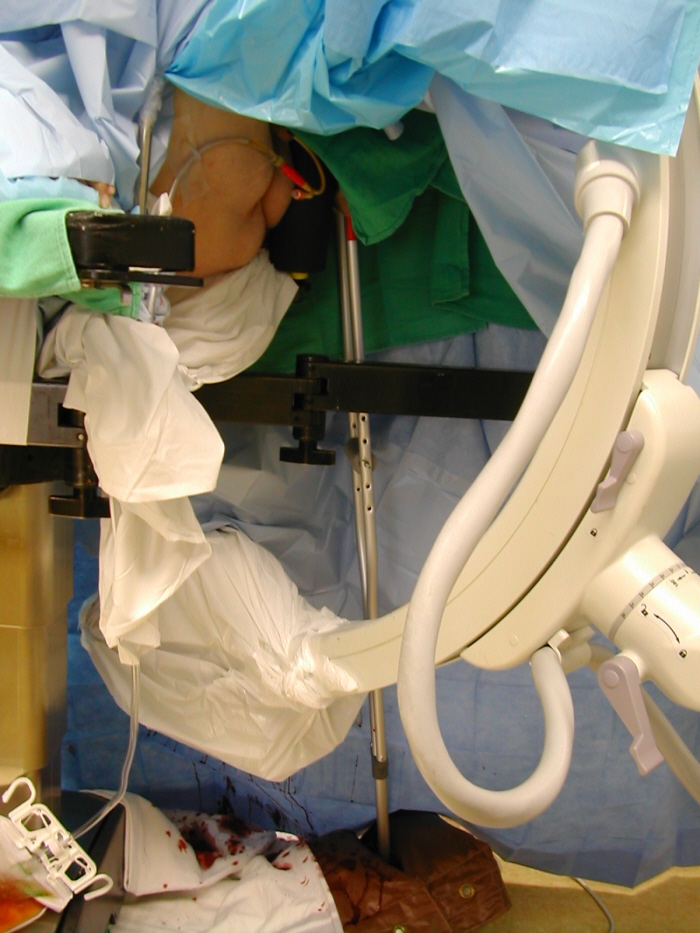 Femur Holder Lifter by Ed McMullin at Coroflot.com