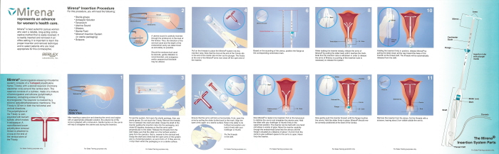Mirena Sales Training Flash Illustration, Animation and Brochure by ...