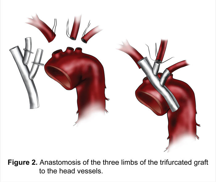 MEDICAL ILLUSTRATION by Ronan Walker at Coroflot.com