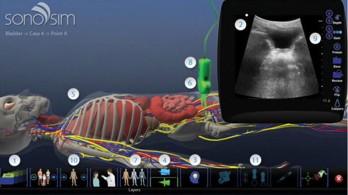 SonoSim Medical Training Software by Shaun McClure at Coroflot.com