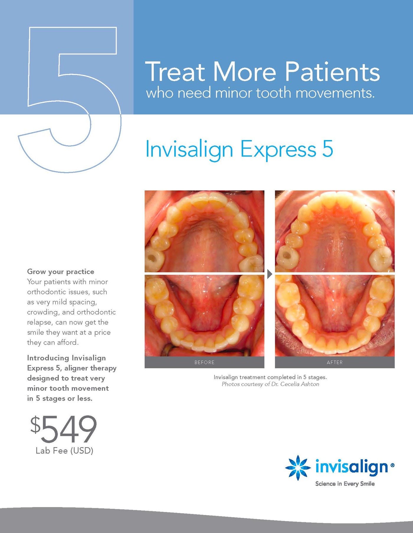 Invisalign Express Orthodontist Data Sheet by Ronda Prothro at Coroflot.com