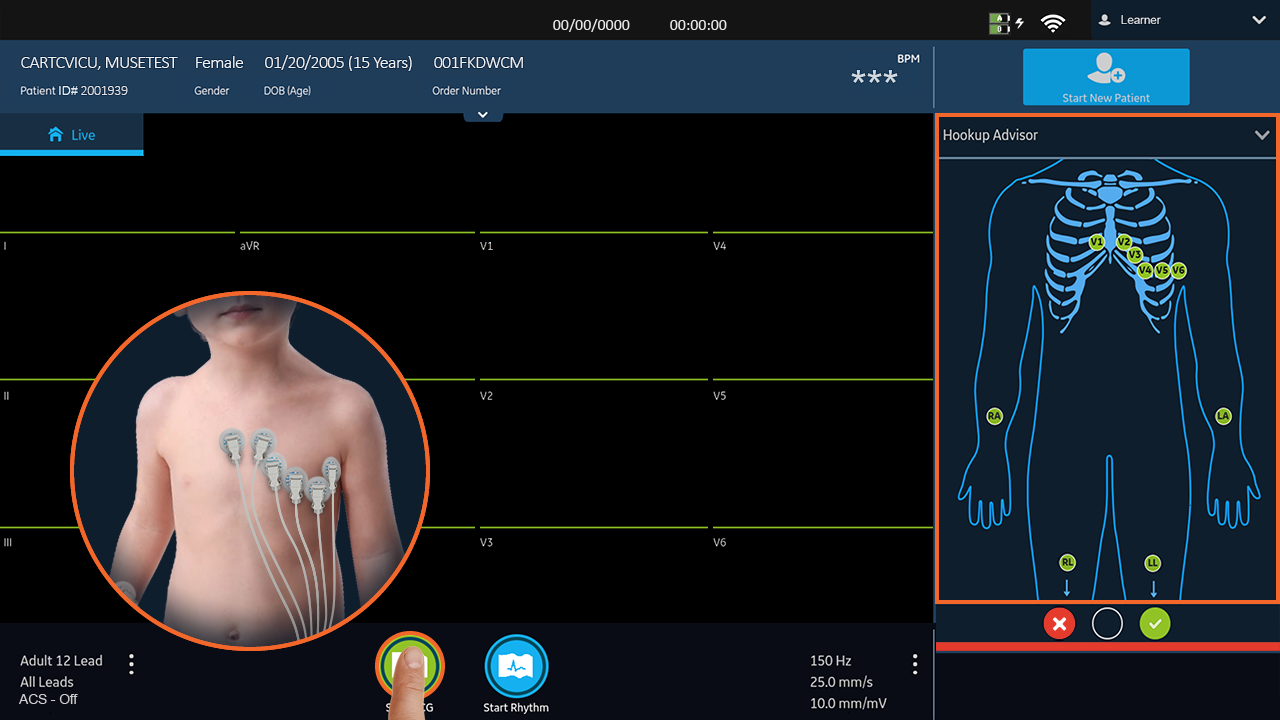 ECG Cart Mac Vu 360 - Course by Joel Calvin, M Ed at Coroflot.com
