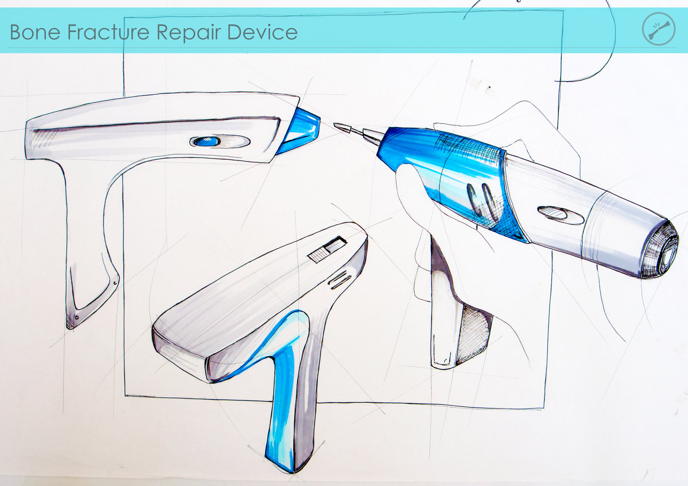 Bone Fracture Repair Device by Michael Heffernan at Coroflot.com