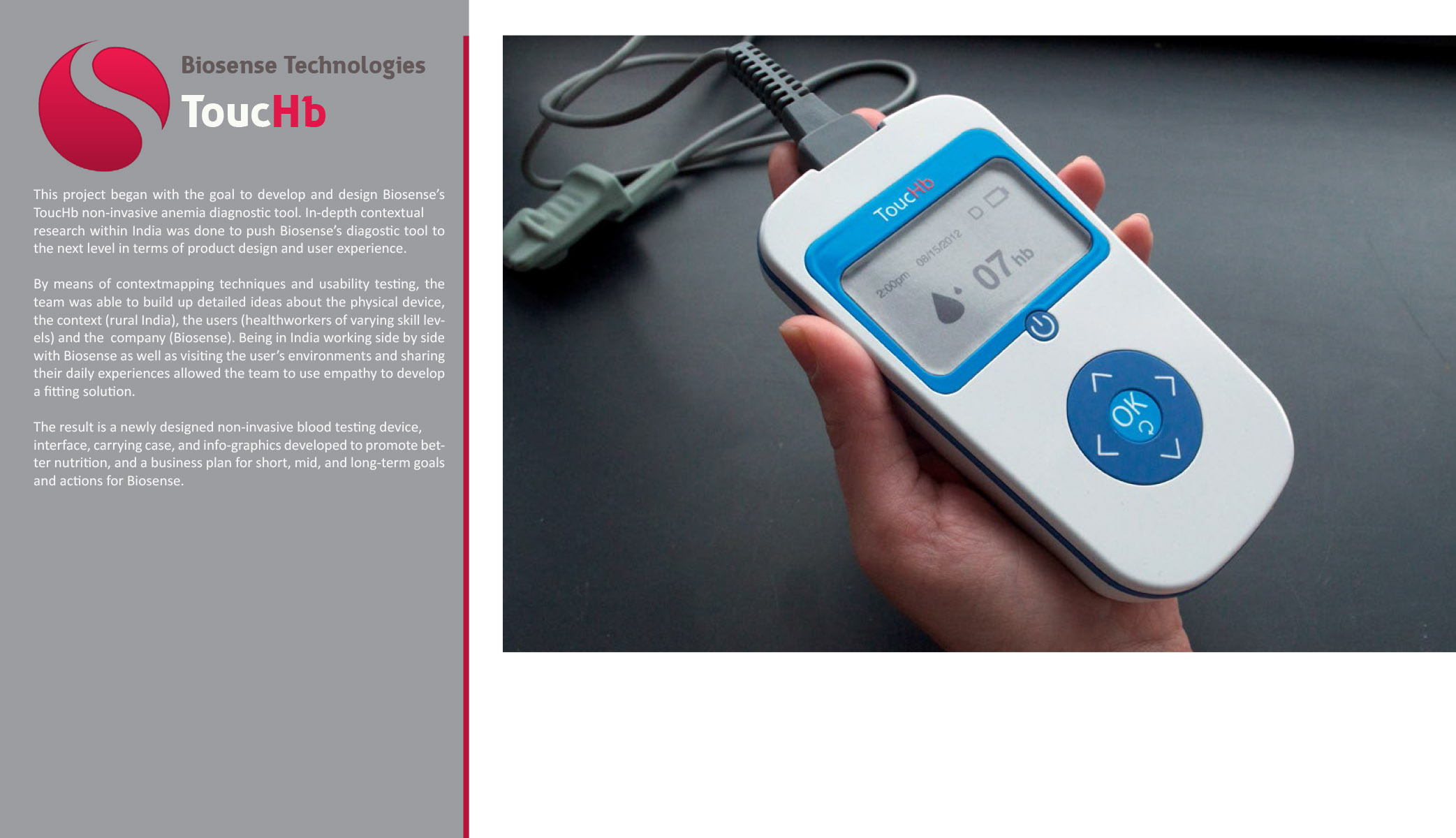 Non-Invasive Anemia Diagnostic Tool for Developing Countries by Ashley ...