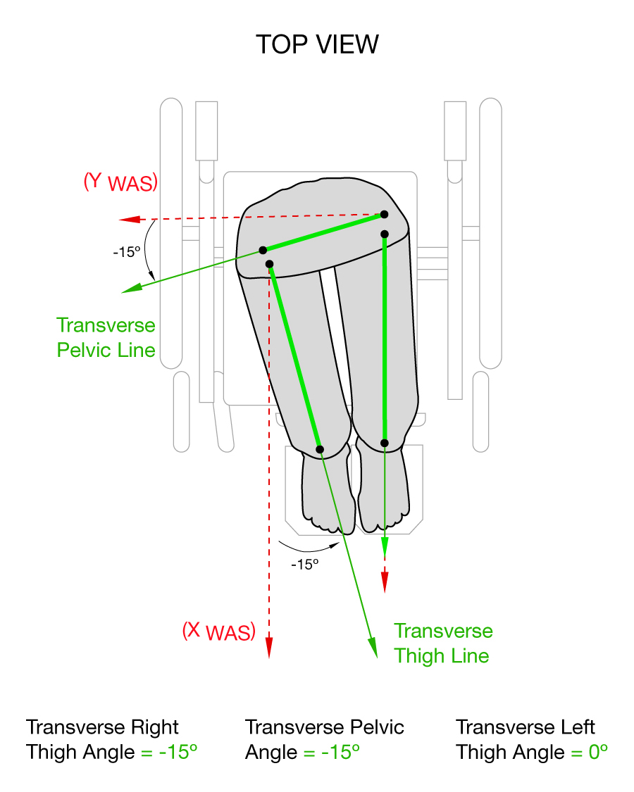 Technical Illustration: Clinical Wheelchair Seating and Positioning ...