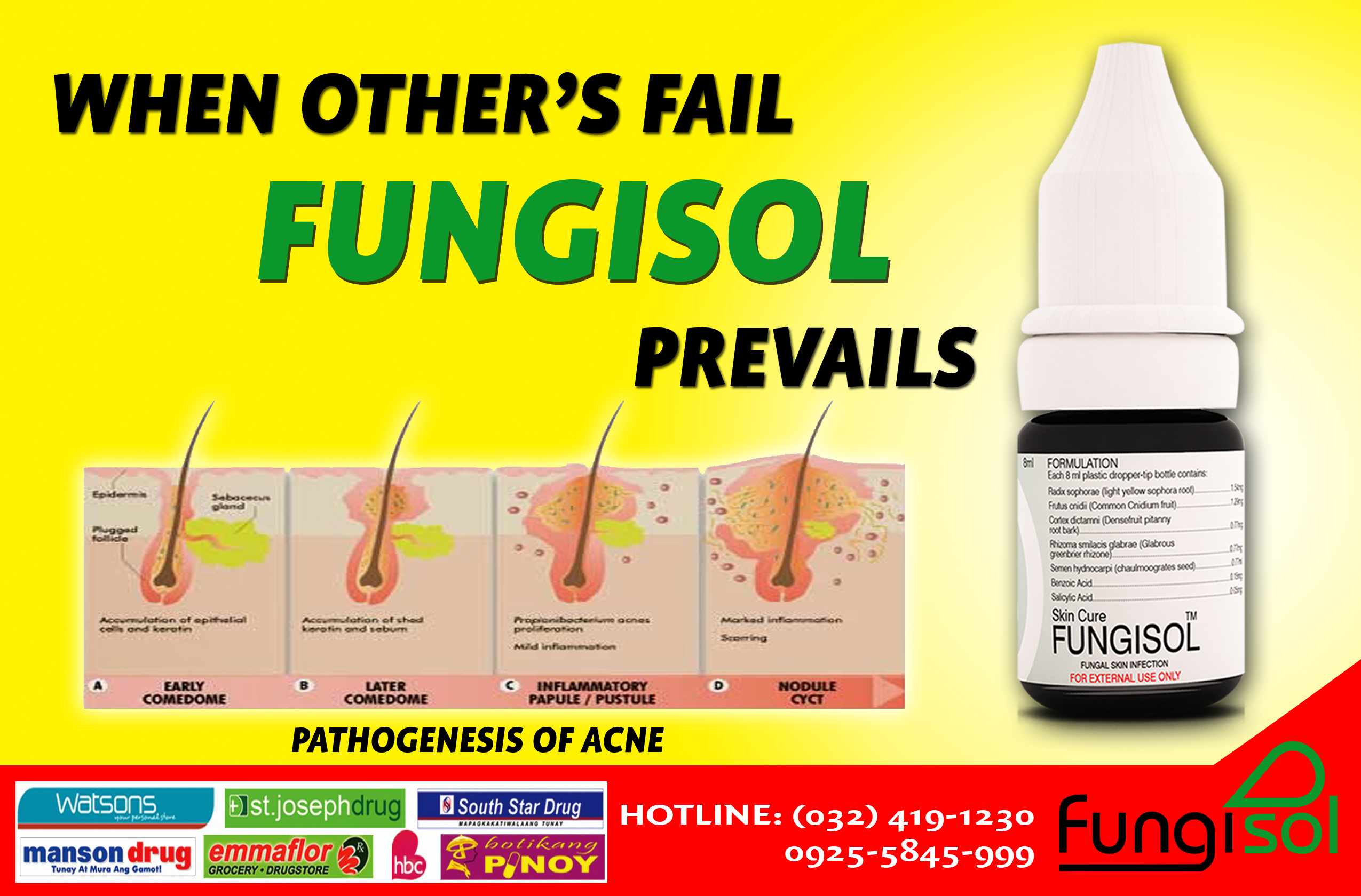 Fungisol Advertisement by Marilyn Sisa at Coroflot.com
